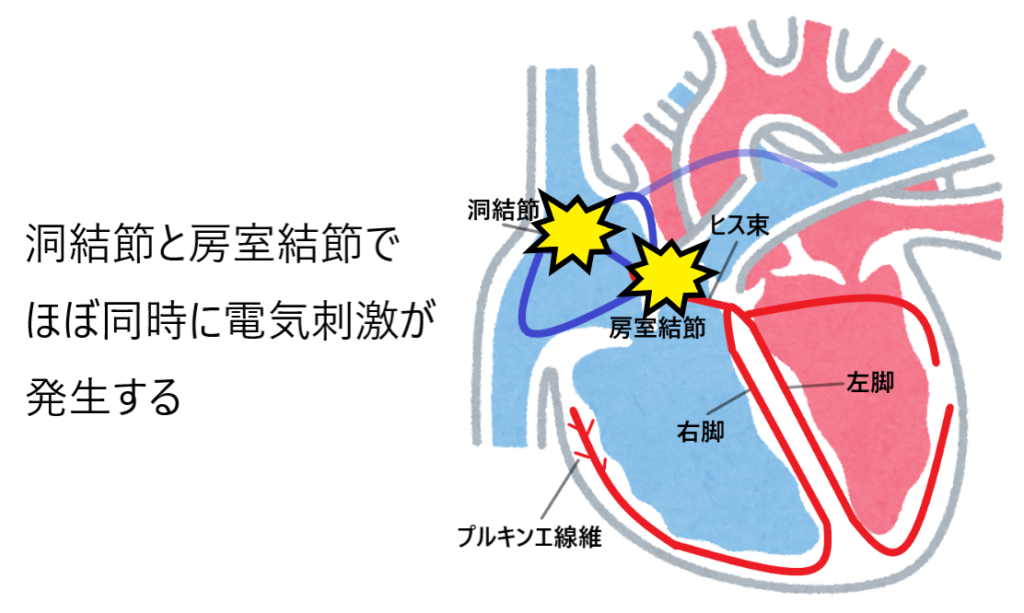 等頻度 イラスト | 心電図の達人
